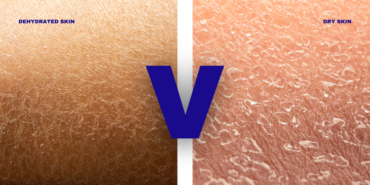 Dehydrated Vs. Dry Skin – Clean Swim